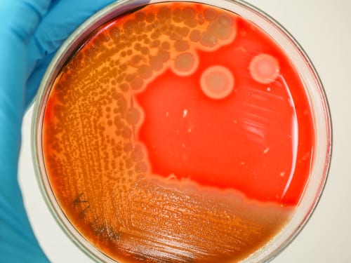 Bacillus Species. Gram-positive Bacteria found in Indoor Environments